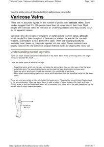 Varicose-Veins – Vernon Street Medical Centre
